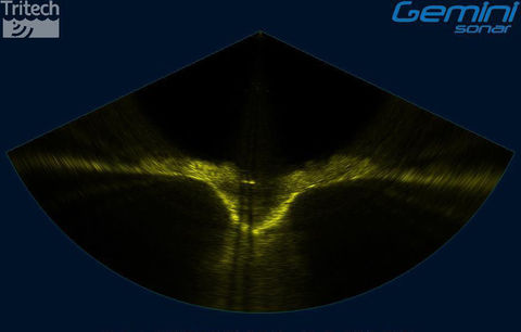 Gemini NBI - Tritech
